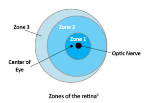 How is ROP diagnosed and staged? – ROP | Patient & Caregiver
